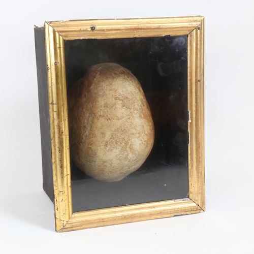 ANATOMY - a cased human skull cap, case dimensions 30cm x 24... | Barnebys