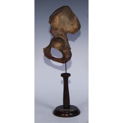 Medical - Anatomy - a hip bone specimen, mounted for display... | Barnebys